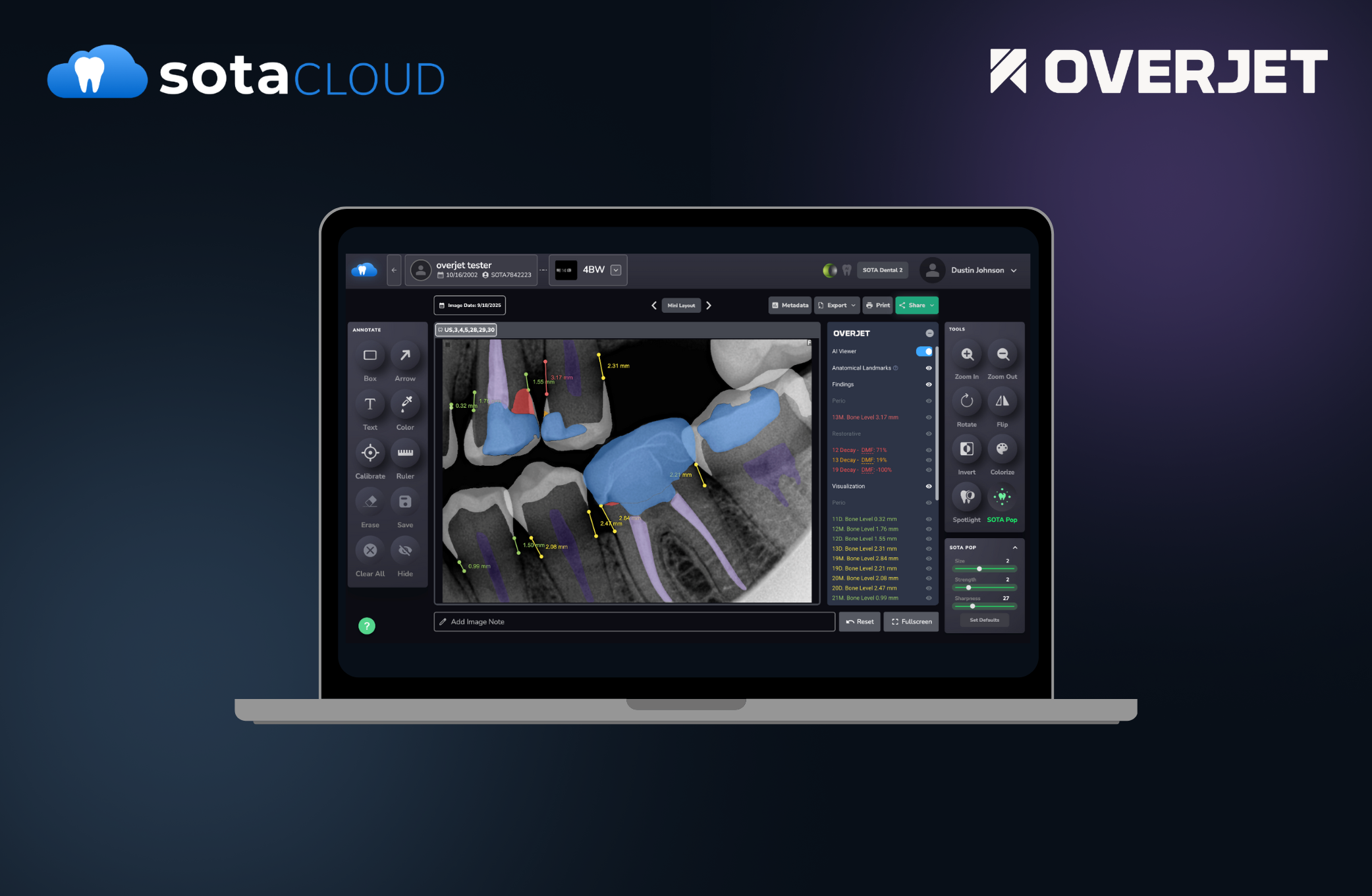 Cloud Imaging Meets Dental AI: SOTA Cloud × Overjet Integration